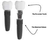Oral Surgery Services & Treatment | NC Oral Surgery + Orthodontics